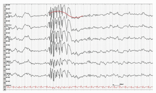New Frontiers in EEG: High and Low Frequencies, High-Density EEG ...