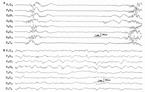 Normal EEG in the Newborn, Infant, and Adolescent | Neupsy Key