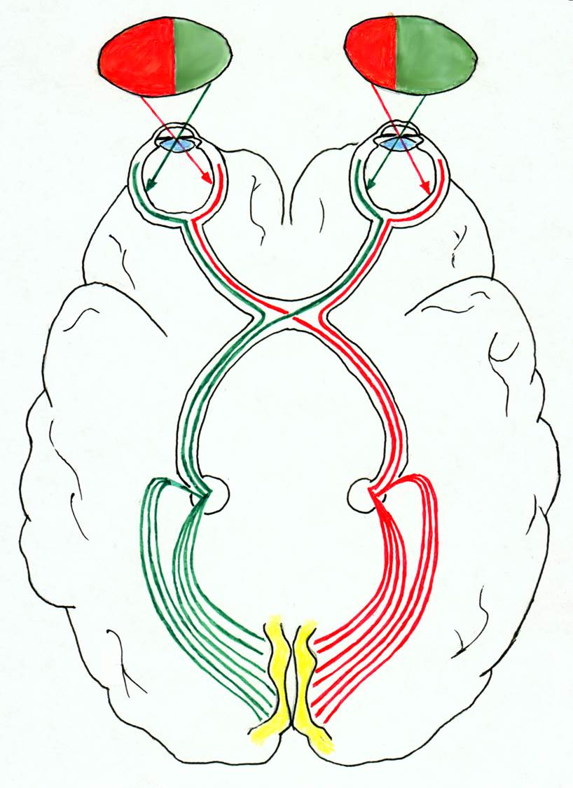Hemianopsie Übungsblätter _ Hemianopsie – KCCR