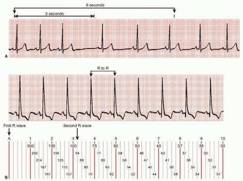 Electrocardiography | Nurse Key