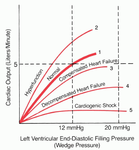 Heart Failure and Cardiogenic Shock | Nurse Key