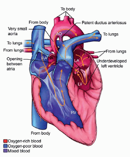 Cardiac Disorders | Nurse Key