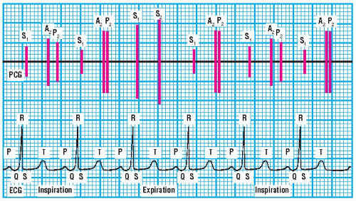 The Second Heart Sound | Nurse Key