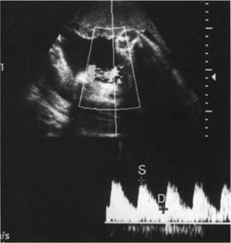 Fetal Imaging: Ultrasound and Magnetic Resonance Imaging | Obgyn Key