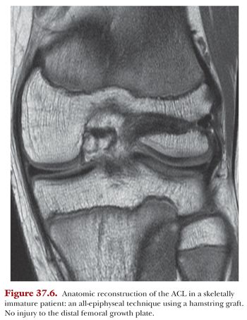 Growth Plate Anatomy | Obgyn Key