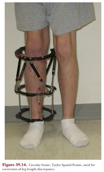 Growth Plate Anatomy | Obgyn Key