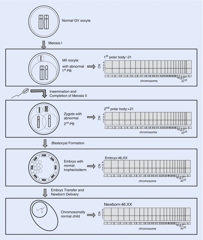 Preimplantation Genetic Diagnosis and Genetic Screening | Obgyn Key