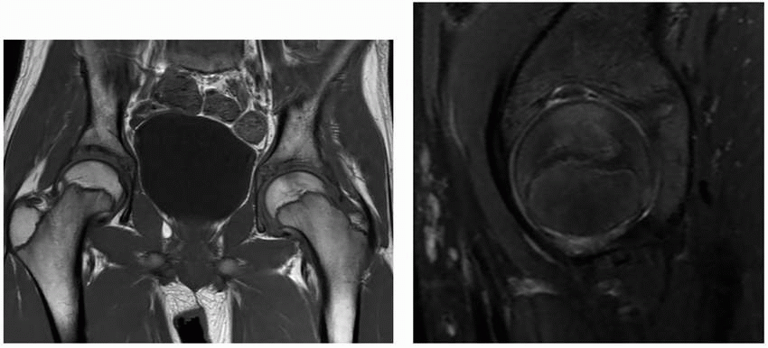 Pediatric Musculoskeletal System | Obgyn Key