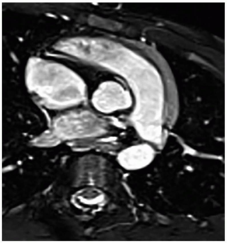 Pediatric Cardiac Radiology | Obgyn Key