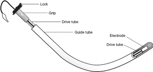 Intrapartum Electronic Fetal Monitoring | Obgyn Key