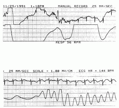Cardiorespiratory Monitoring | Obgyn Key