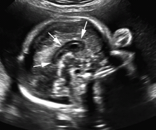Second and Third Trimester Fetal Anatomy | Obgyn Key