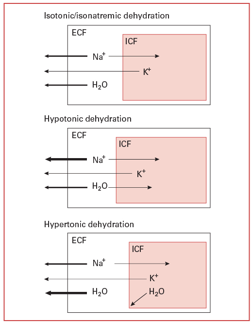 Management of Dehydration in Children: Fluid and Electrolyte Therapy ...