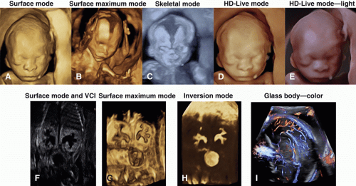 Three- and Four-Dimensional Ultrasound and Magnetic Resonance Imaging ...