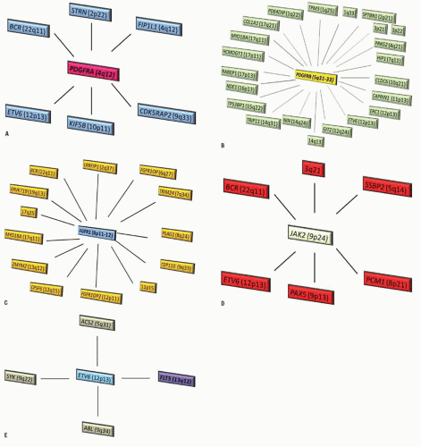 Eosinophilic Neoplasms and Hypereosinophilic Syndrome | Oncohema Key