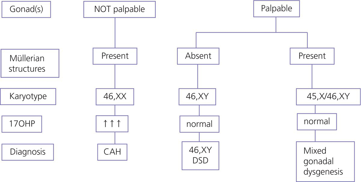 Differences In Sex Development And Common Genital Anomalies Oncohema Key