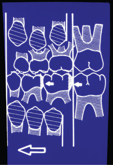 Craniofacial growth and development | Pocket Dentistry