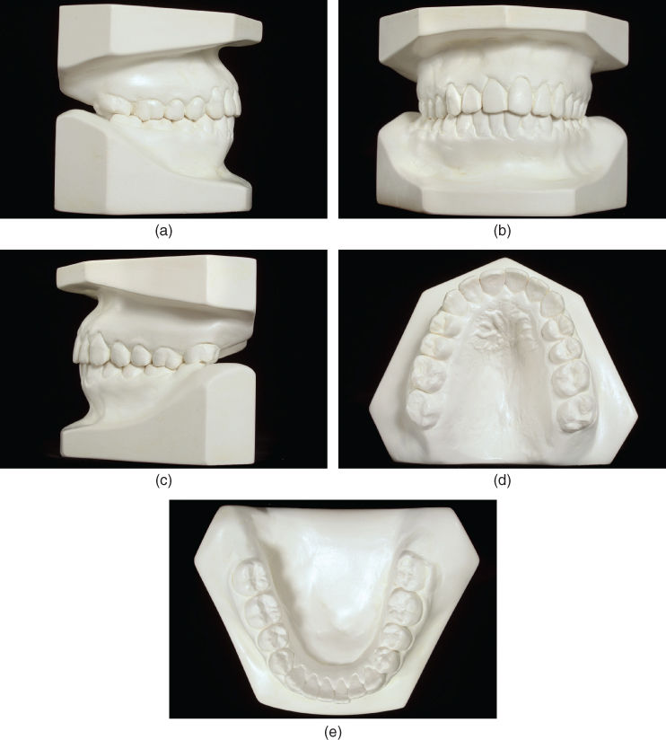 Diagnostic examinations | Pocket Dentistry