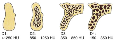 Radiographic Complications and Evaluation | Pocket Dentistry