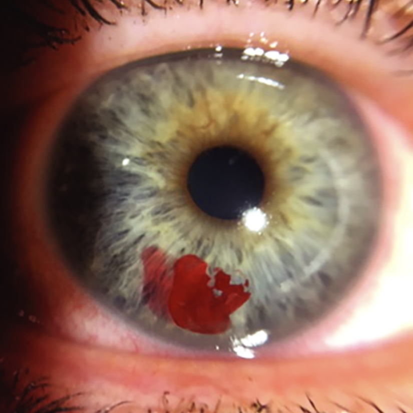 Protecting Sight #239: How a green economy could work for you. IOL ...