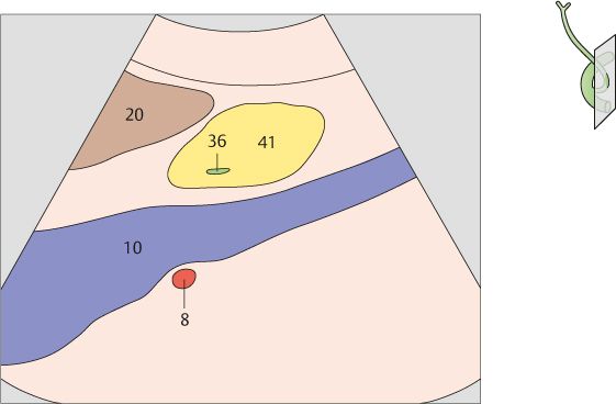 Gallbladder | Radiology Key