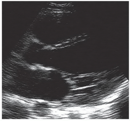 Echocardiography Radiology Key