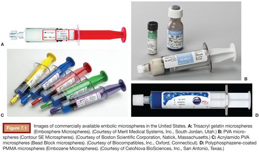 Spherical Embolic Agents | Radiology Key