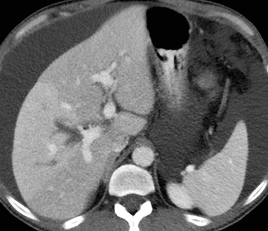 Liver | Radiology Key