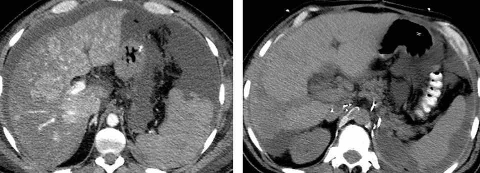 Liver | Radiology Key