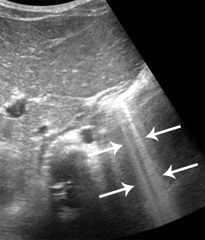 Bile Ducts and Gallbladder | Radiology Key