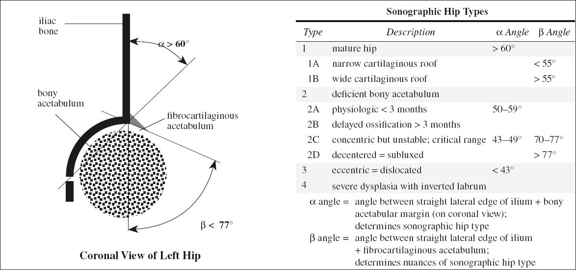and Soft-Tissue Disorders | Radiology Key