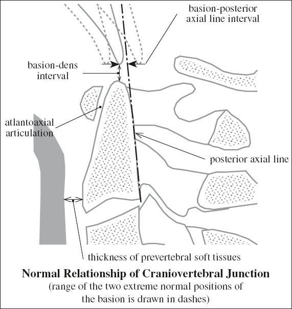 of Skull and Spine | Radiology Key