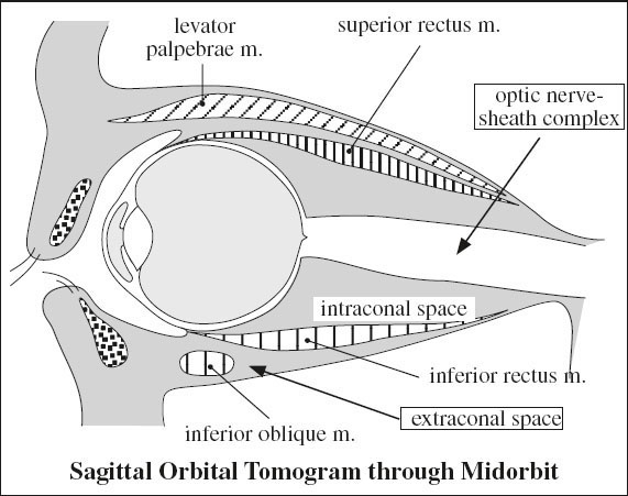 of Orbit | Radiology Key