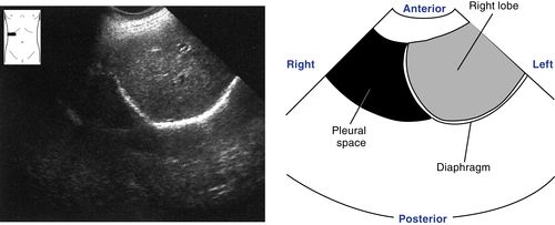 Liver Scanning Protocol | Radiology Key
