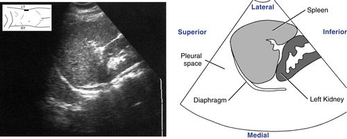 Spleen Scanning Protocol | Radiology Key