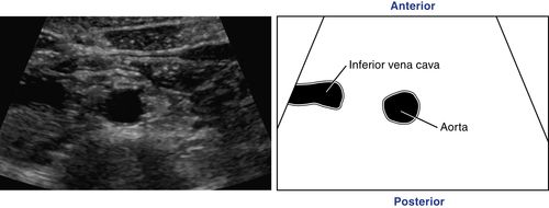 Peripheral Arterial and Venous Duplex Scanning Protocols | Radiology Key