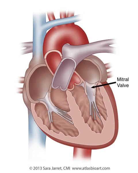 Endoscopic Robotic Mitral Valve Repair With Percutaneous Cannulation endoscopic-robotic-mitral-valve-repair-with-percutaneous-cannulation