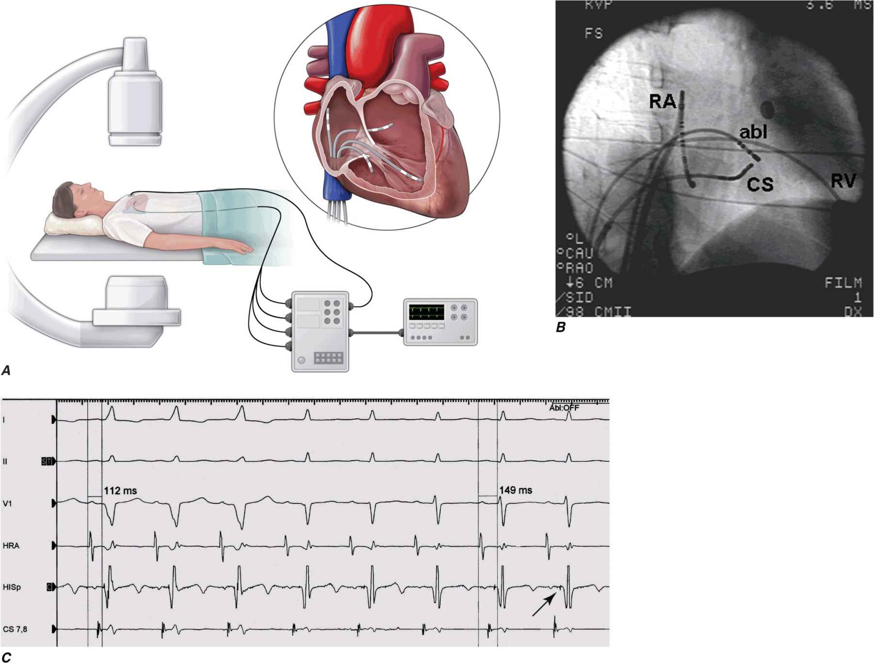 Principles of Electrophysiology | Thoracic Key