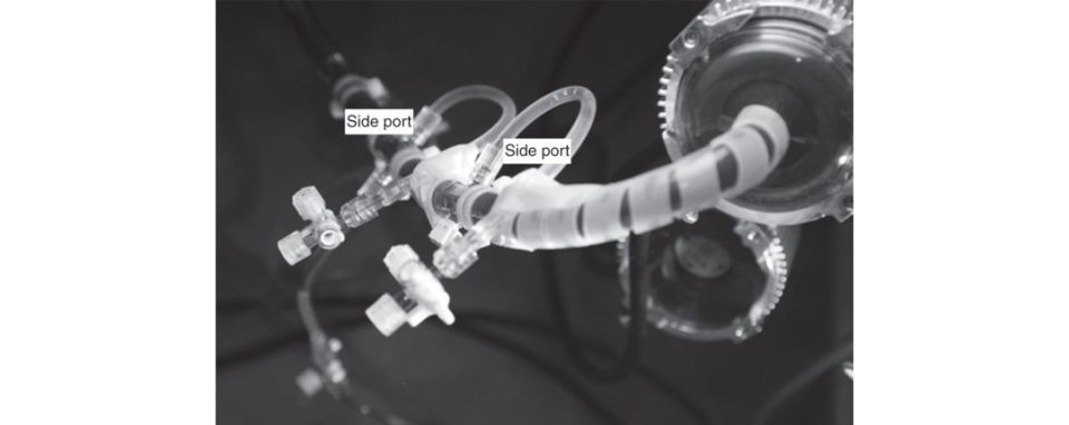 The ECMO circuit | Thoracic Key