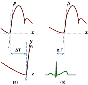 Pulse Wave Velocity and Arterial Stiffness Assessment | Thoracic Key