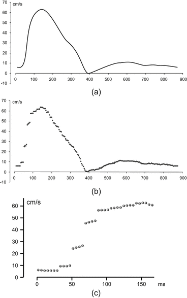 Pulse Wave Velocity and Arterial Stiffness Assessment | Thoracic Key