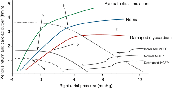 Hemodynamics and Heart Failure | Thoracic Key