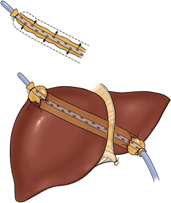 Abdomen | Thoracic Key