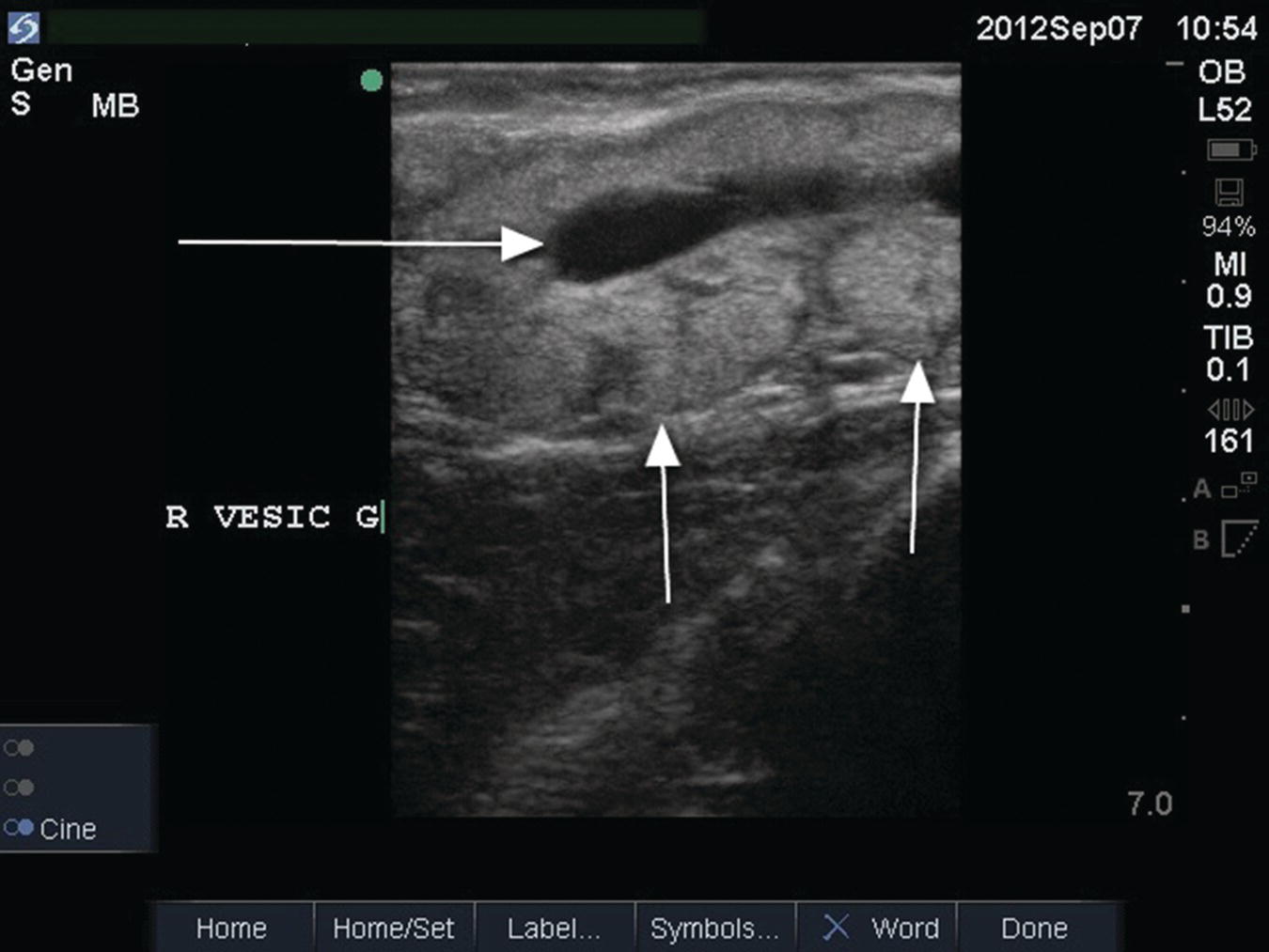 Ultrasound Evaluation of the Reproductive Tract of the Bull | Veterian Key