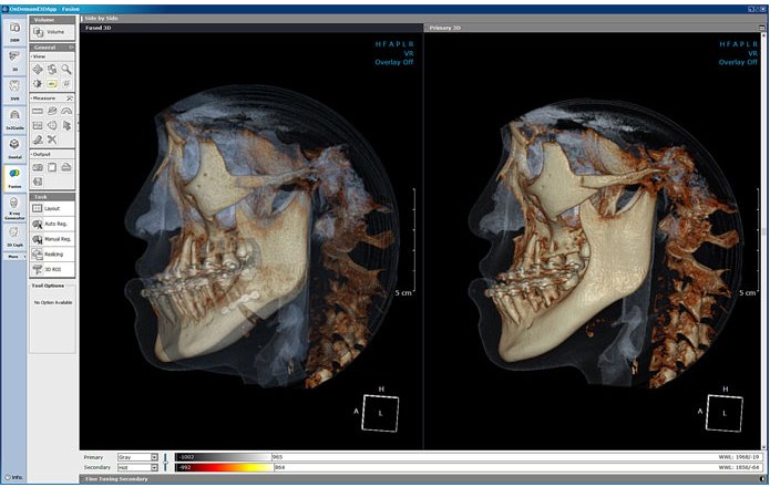 Cybermed OnDemand3D Sentinel Hasp HL Dongle - Vip Dongle Team