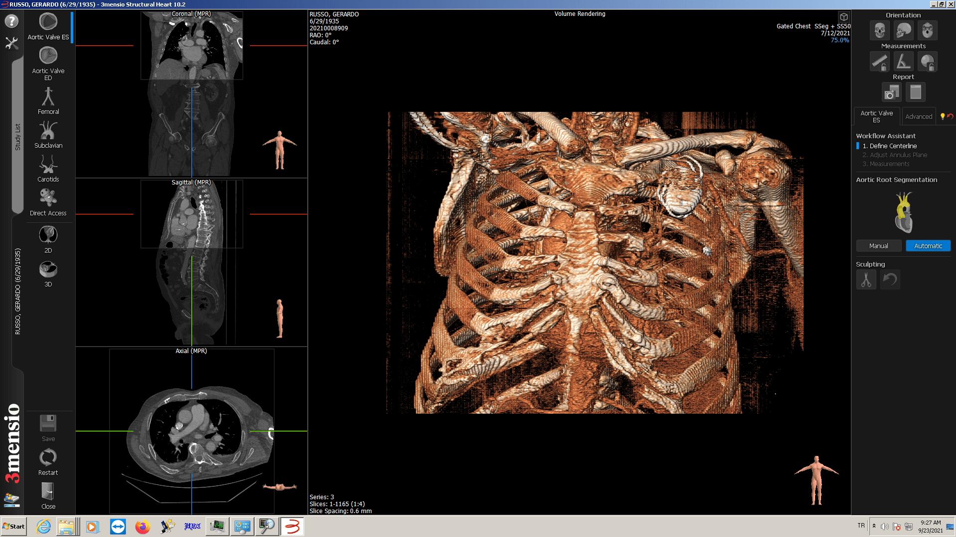 3mensio Vascular Sentinel SL License - Vip Dongle Team