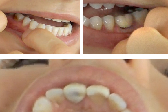 Health Risks of Bulimia and 5 Tips to Avoid them - Islam and Eating ...