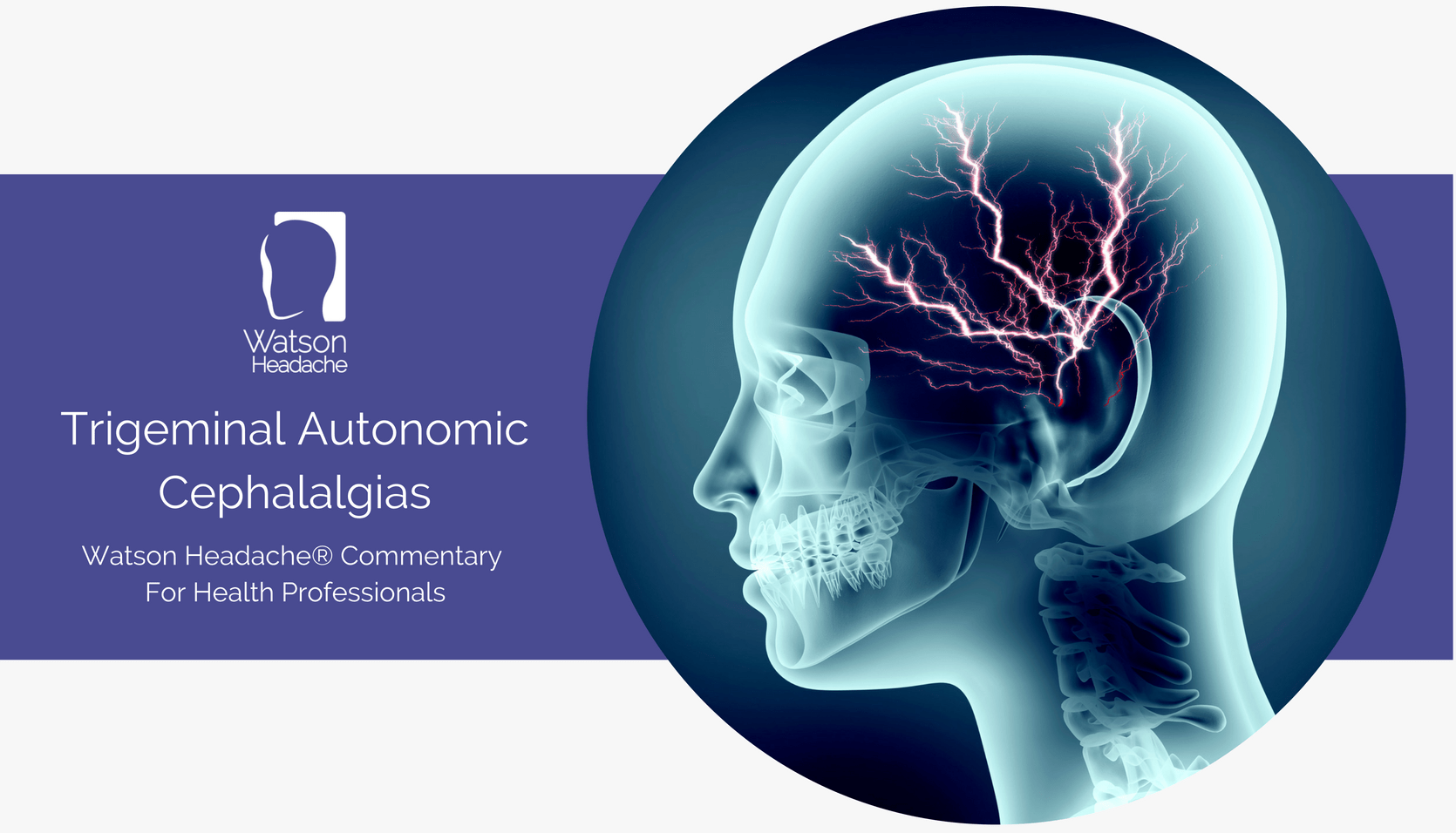 Trigeminal Autonomic Cephalalgias - Watson Headache