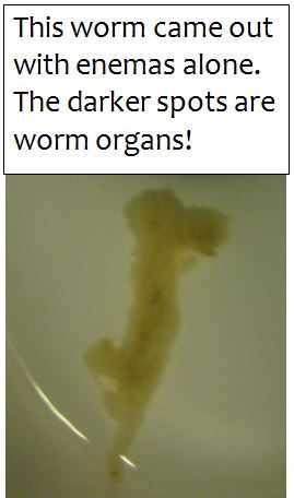 Human Parasite Pictures - Debug Your Health