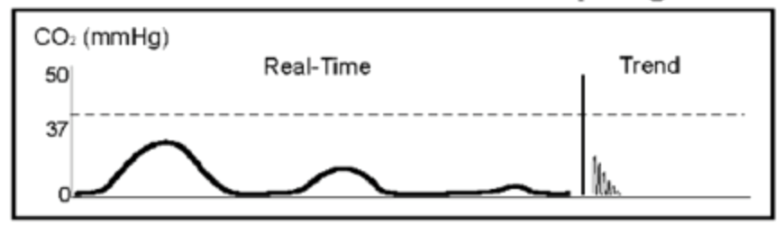 Interpreting Waveform Capnography: Pearls and Pitfalls - emdocs